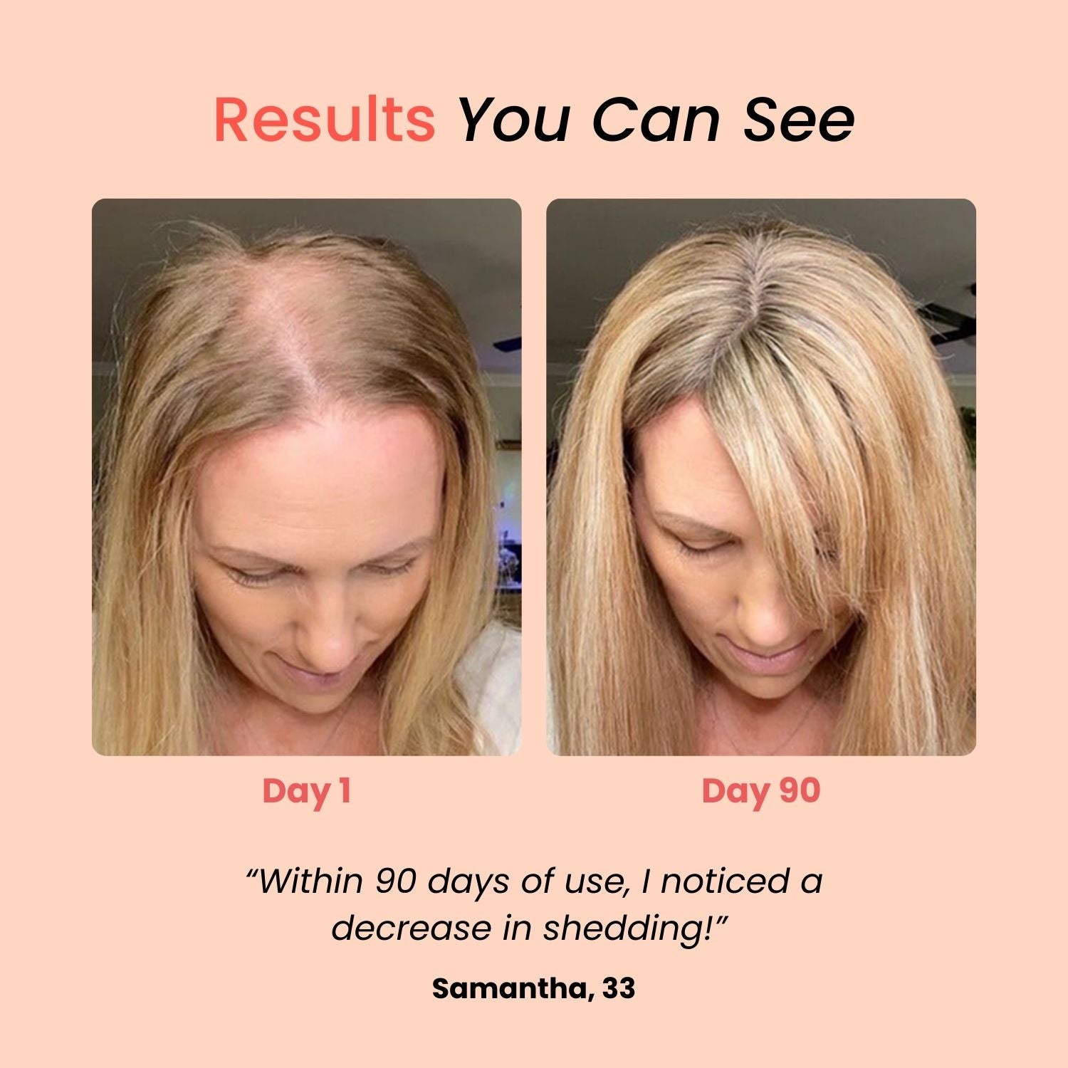 4-in-1 Hair Growth Revival Wand with Red Light Therapy – Bloomly