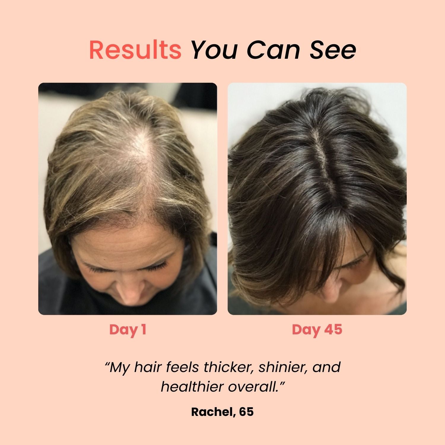 4-in-1 Hair Growth Revival Wand with Red Light Therapy – Bloomly